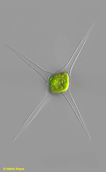 Actinosphaerium Eichhornii Real Micro Life