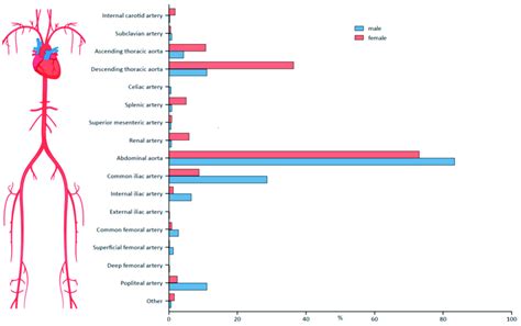 Percentage Of Aneurysm Formation In Each Arterial Segment Of Men And