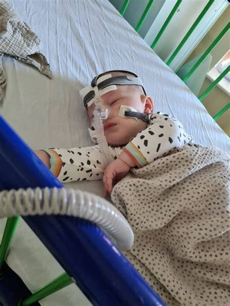 What Is The Cause Of Congenital Central Hypoventilation Syndrome Keep