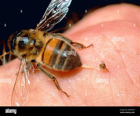 Bee Sting View Of A Honeybee Apis Mellifera In The Process Of Stinging