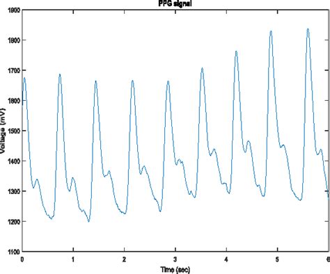 Figure 5 From Wearable Emotion Recognition System Based On Gsr And Ppg Signals Semantic Scholar