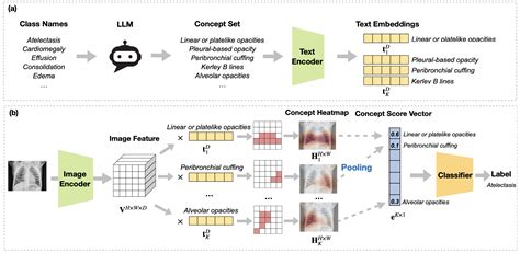 sparse feature circuits discovering and editing interpretable causal