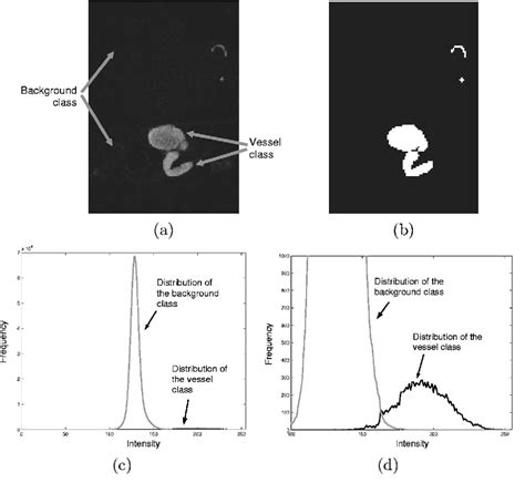 Figure 1 From Statistical Cerebrovascular Segmentation In Three