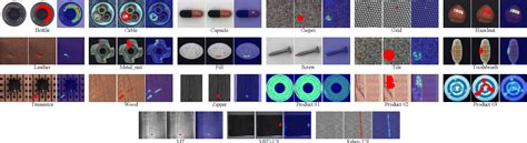 Multi Feature Reconstruction Network Using Crossed Mask Restoration For Unsupervised Anomaly