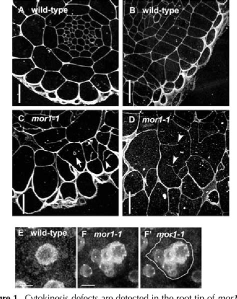 Figure 1 From Microtubule Organization 1 Regulates Structure And Function Of Microtubule Arrays