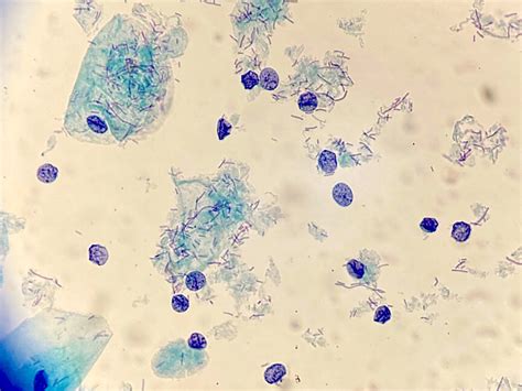 Frontiers The Vaginal Microenvironment The Physiologic 57 Off