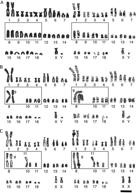 Chromosomal Polymorphism In The Gray Shrew Crocidura Attenuata Mammalia Insectivora