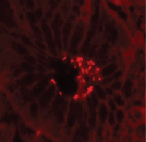 Specific Detection Of Clarithromycin Sensitive And Download