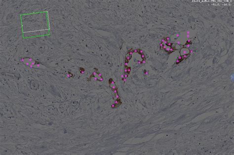 Visualization Of Alignment In Qupath Doesnt Match Quality Of Imagej