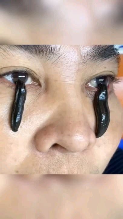 Festering Vomitous Mass