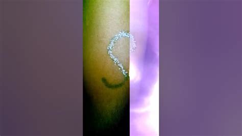 ট্যাটু রিমুভ করা হয় ও মেছতা জন্মগত দাগ উঠানো হয় যোগাযোগ নাম্বার 01611144716 Youtube