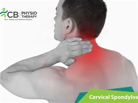 Top 5 Exercises For Cervical Spondylosis Png