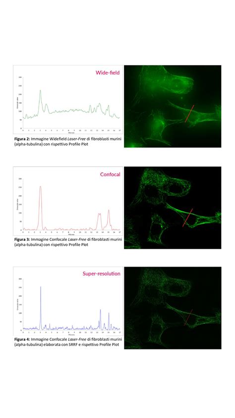 Fig 2 Super Resolution Media System Lab