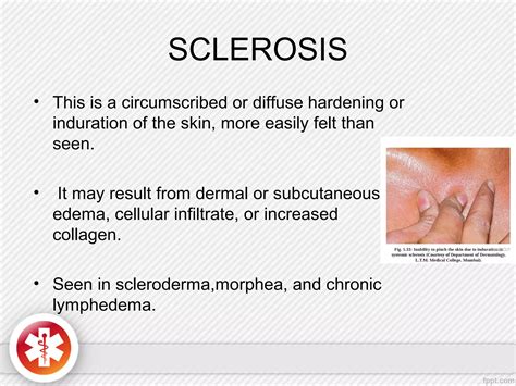 Secondary Lesions And Special Lesions In Dermatology Ppt