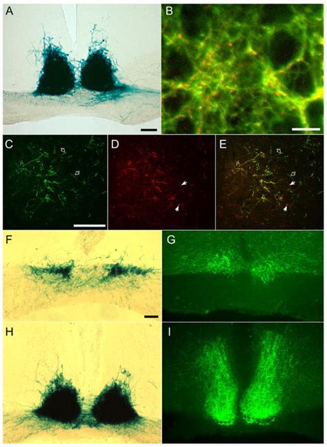 Central Projections Of Melanopsin Expressing Retinal Ganglion Cells In The Mouse Pmc
