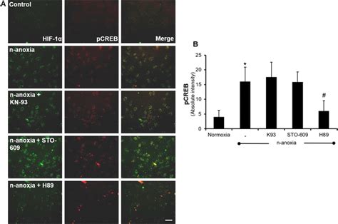 Co Localization Of Hif 1α And Pcreb In Astrocytes Under N Anoxia Download Scientific Diagram