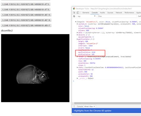 Display Dicom Images With Cornerstonewadoimageloader But Lose Grayscale · Issue 124