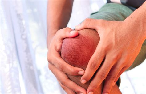 How Do You Treat Synovitis Chris Bailey Orthopaedics