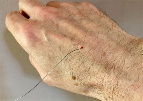 Bizarre Guitar Related Freak Accident — Haze Guitars
