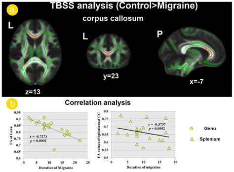 A Tract Based Spatial Statistics Tbss Analysis Revealed Decreased