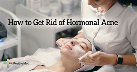 How To Get Rid Of Hormonal Acne Positivemed