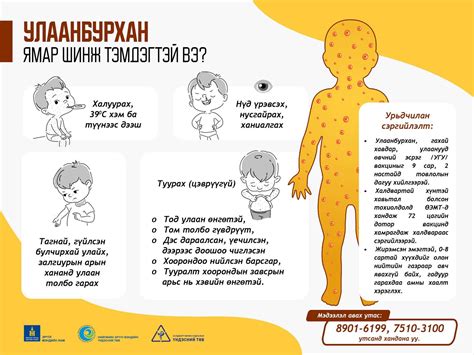 Дорноговь 👶🧼 Улаанбурхан өвчнөөс сэргийлье 🛡️ 1️⃣ Дархлаажуулалтаа хийлгээрэй 💉 👉