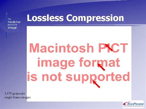 The Medicine Behind The Image DICOM Compression