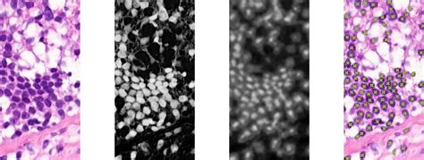 The Steps Of The Proposed Method For Generic Detection Of Nuclei From