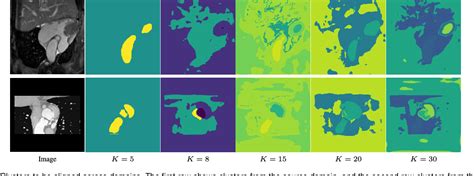 Figure From Shape Aware Joint Distribution Alignment For Cross Domain Image Segmentation