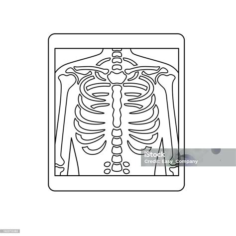 X Ray Black And White Clipart