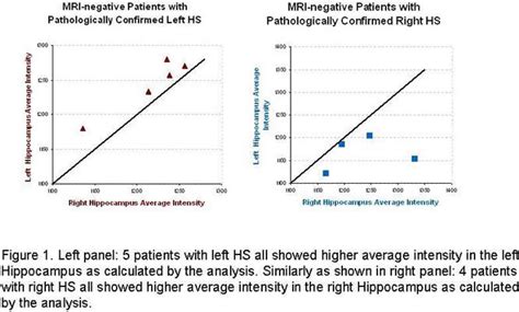Lateralization Of Meg Negative Mesial Temporal Lobe Epilepsies Using Quantitative Hippocampal
