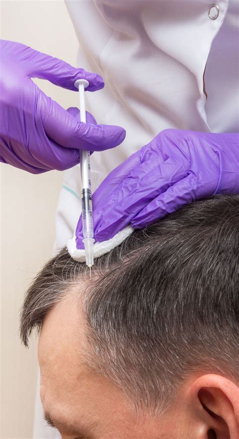 Prp For Men In Miami Platelet Rich Plasma For Men Miami Mens