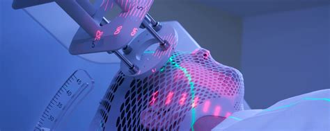 latest advances in non invasive cancer treatments and therapies stellaix