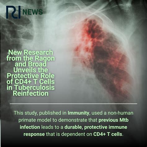 Tb Tuberculosis Research Vaccination Ragoninstitute Ragon Institute Of Mass General