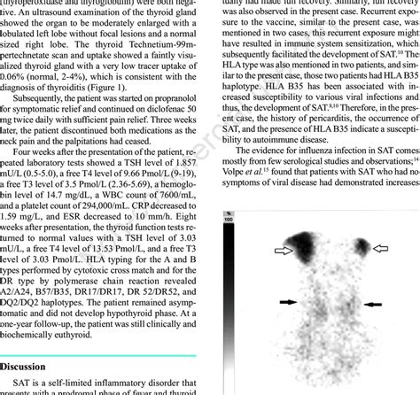 Thyroid Technetium Scan Showing Diffuse Poor Tracer Uptake Within The