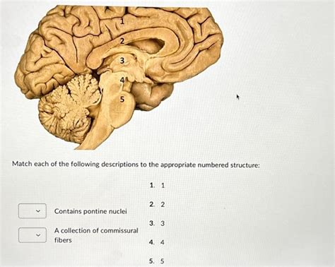 solved answer fast match each of the following descriptions