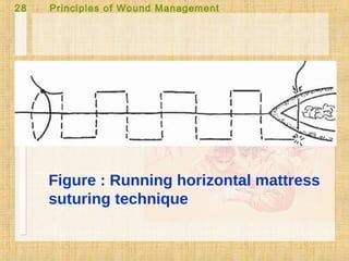 Wound Management Ppt