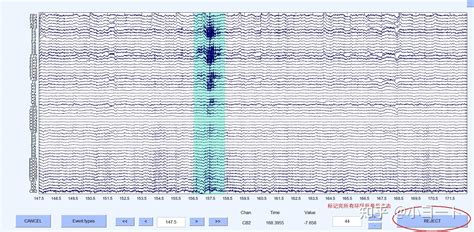 手把手系列教程 使用eeglab2023版对脑电数据进行预处理 知乎