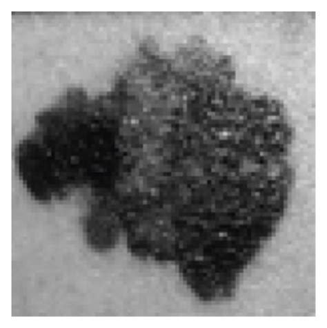 Suspicious Sample A Input Image B Contrast Limited Histogram Download Scientific Diagram