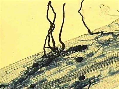 Mycorrhizae Microscope