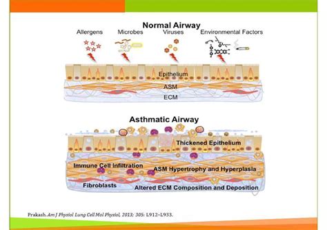Bronchial Provocation Test In Clinical Practice Pdf