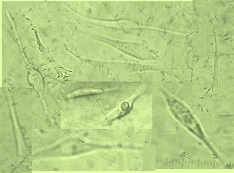 Adult Human Endometrial Stem Cells Were Cultured Under Appropriate Download Scientific Diagram