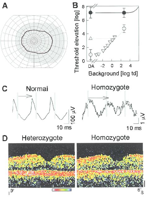 Human Phenotype Of Putative Null Mutation In Rpe65 A Kinetic Visual Download Scientific