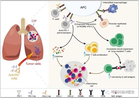 肺癌免疫治疗并非无毒无害，用前需充分评估，有些严重副反应很难治愈澎湃号·湃客澎湃新闻 The Paper