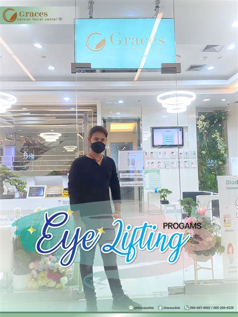 RF EYE LIFTING (Radiofrequency Therapy) “ | Graces