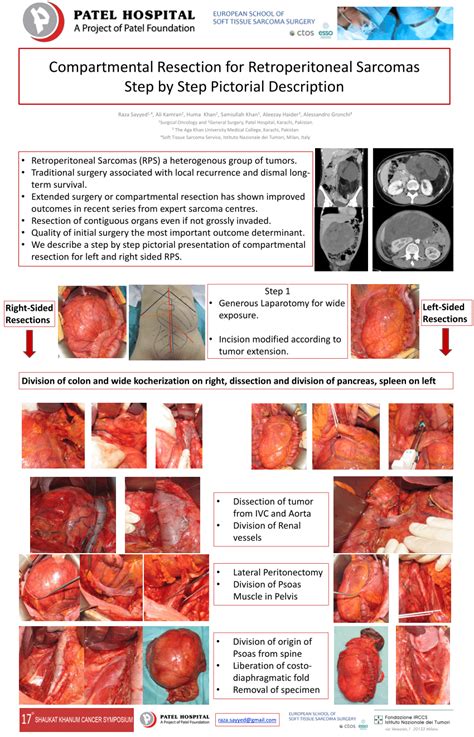 Pdf Compartmental Resection For Retroperitoneal Sarcomas Step By Step Pictorial Description