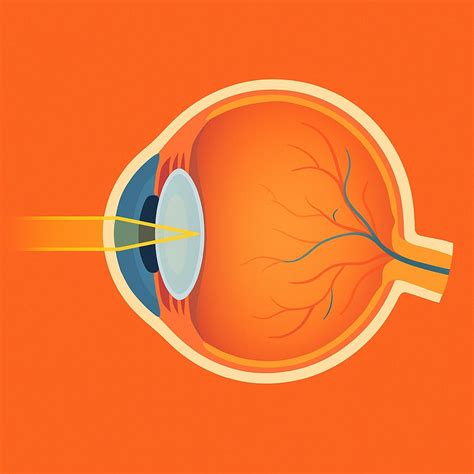 Que Es Miopia Blog Lookstoremx