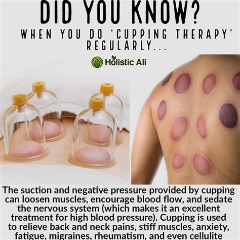 21 Cupping Therapy Chart Ideas Cupping Therapy Cupping Massage Massage Therapy