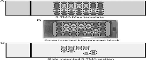 Recommendations For Tissue Microarray Construction And Quali