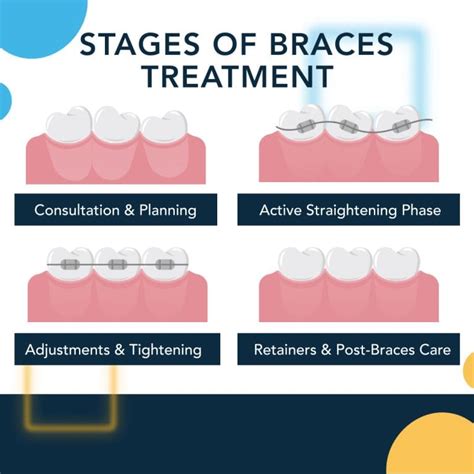 How Long Do Braces Take To Straighten Teeth Smile Every Day Dentistry